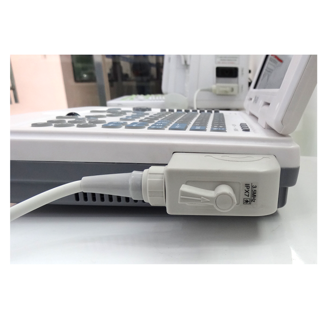 12.1 inch HD LCD Digital Laptop Ultrasound Scanner